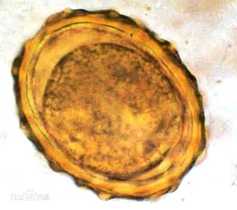 2000 pieces in one breath? Scientists try to eat roundworm eggs with ...