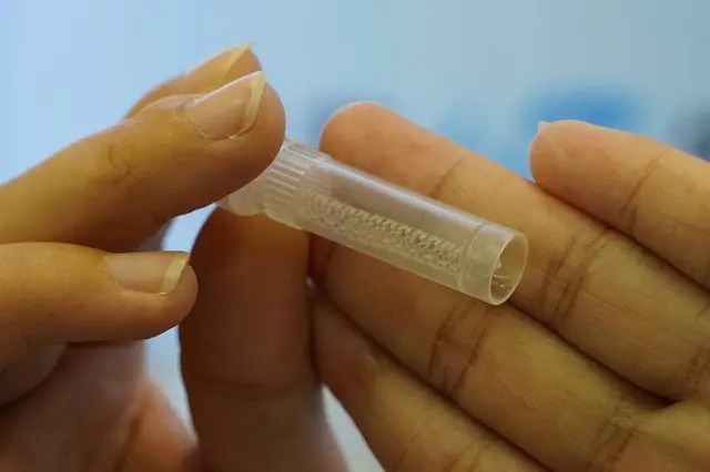 Weigao stepped in to complete hundreds of millions of yuan in financing ...